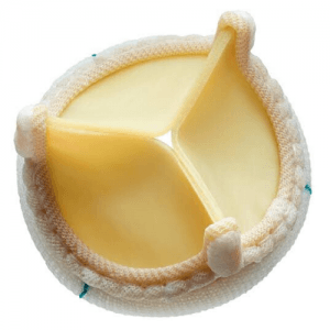 Válvula Biológica – Avalus – Medicicor