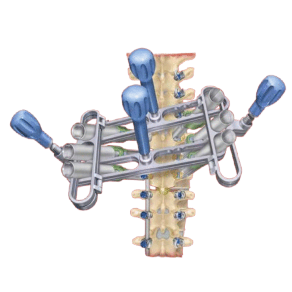 Sistema de derrotação Smartlink – Medicicor